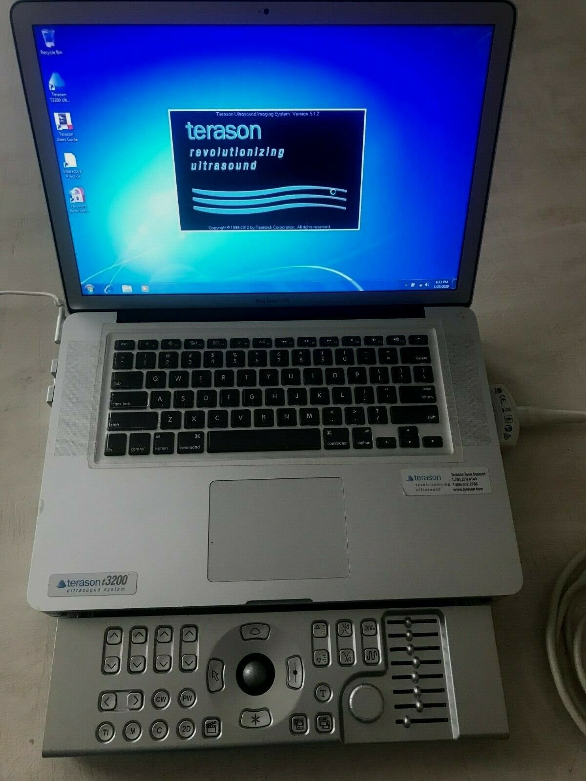 Terason t3200 Ultrasound System | KANAWHA MEDICAL SUPPLY INC