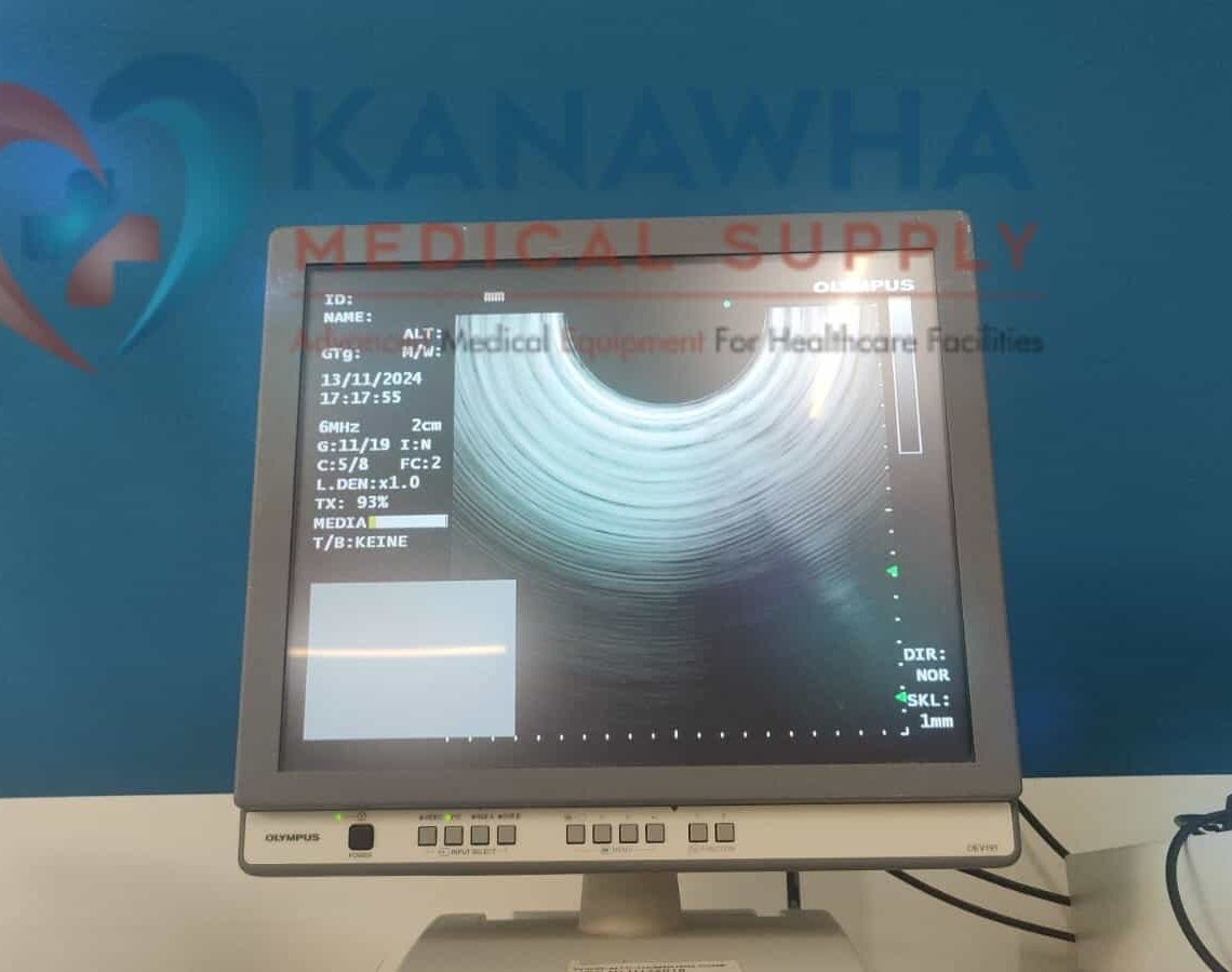 Olympus GF-UCT180 Endoscopic Ultrasound | Kanawha Medical